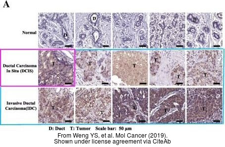 MCTS1抗体 [N1C3] (GTX117793) | GeneTex中国官方网站