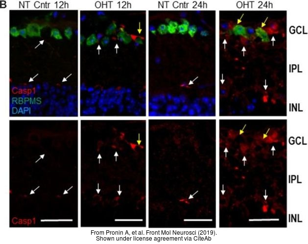 RBPMS抗体 (GTX118619) | GeneTex中国官方网站