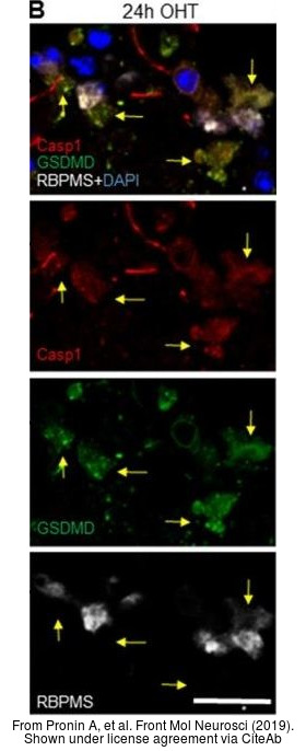 RBPMS抗体 (GTX118619) | GeneTex中国官方网站