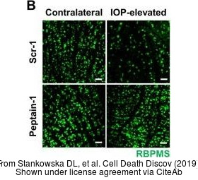 RBPMS抗体 (GTX118619) | GeneTex中国官方网站