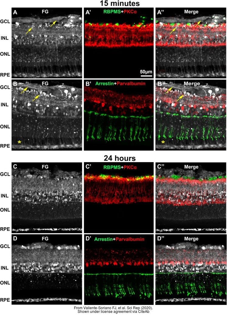 RBPMS抗体 (GTX118619) | GeneTex中国官方网站
