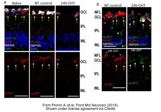 RBPMS抗体 (GTX118619) | GeneTex中国官方网站