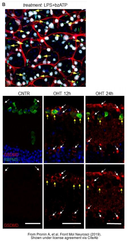 RBPMS抗体 (GTX118619) | GeneTex中国官方网站