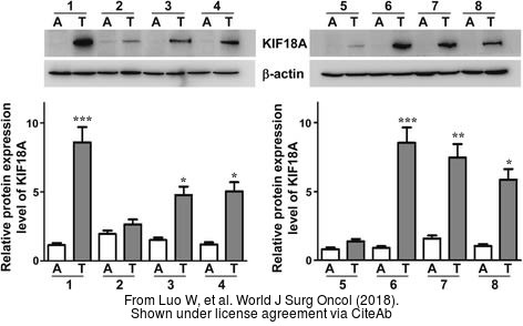 KIF18A抗体 [N1N2], N-term (GTX119467) | GeneTex中国官方网站