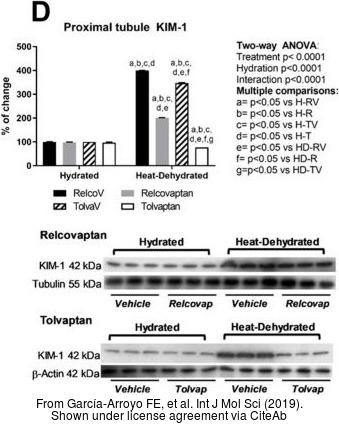 TIM-1抗体 (GTX12016) | GeneTex中国官方网站