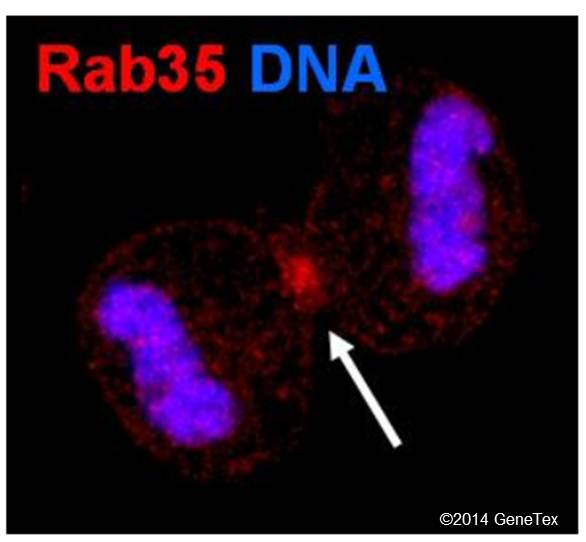 RAB35抗体 [N1C3] (GTX120294) | GeneTex中国官方网站