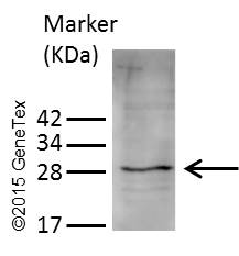 RPS8抗体 [N1C3] (GTX120300) | GeneTex中文官方网站