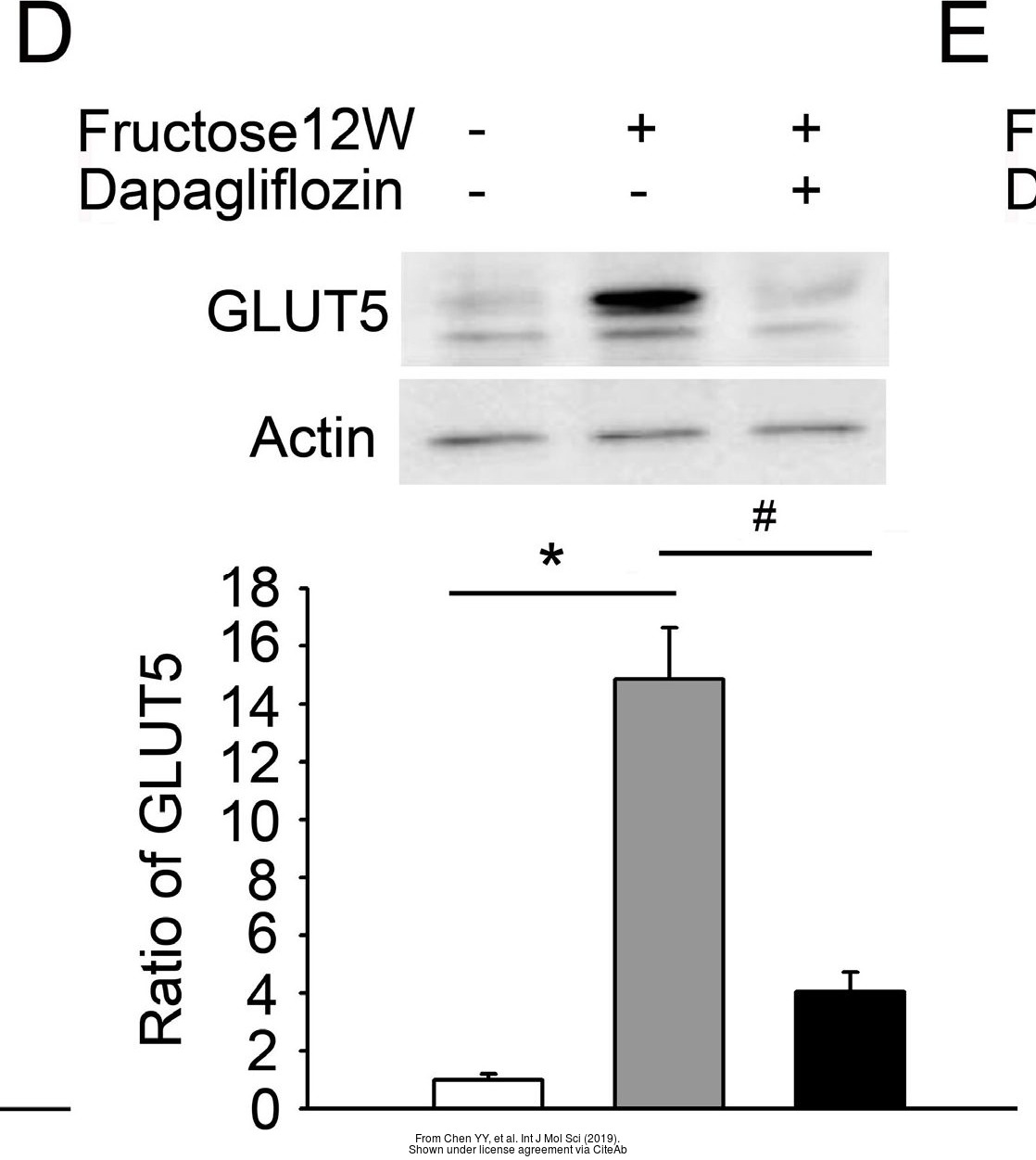 GLUT5抗体 (GTX12098) | GeneTex中国官方网站