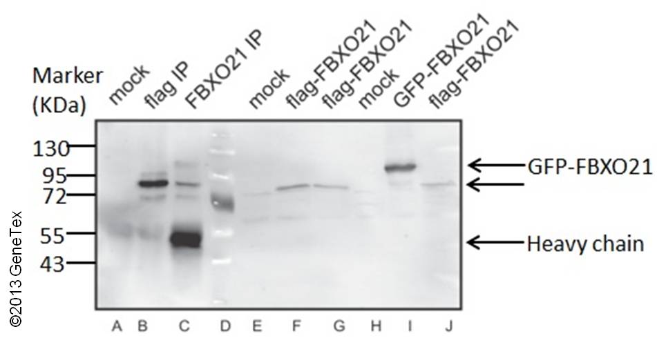 FBXO21抗体 (GTX121415) | GeneTex中文官方网站