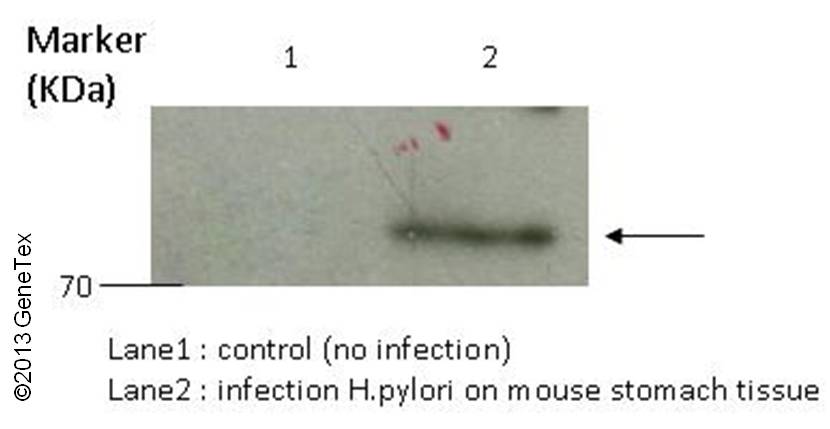 Helicobacter pylori urease B抗体 (GTX124110) | GeneTex中国官方网站
