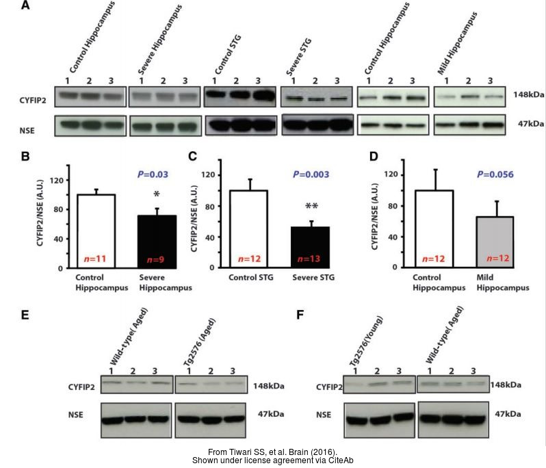 Cyfip2抗体 (GTX124387) | GeneTex中国官方网站