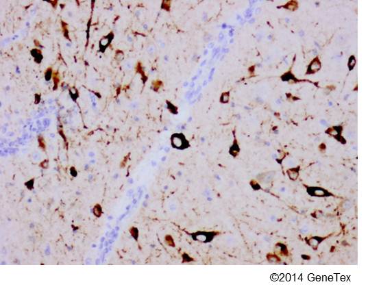 Japanese encephalitis virus Envelope抗体 (GTX125867) | GeneTex中文官方网站