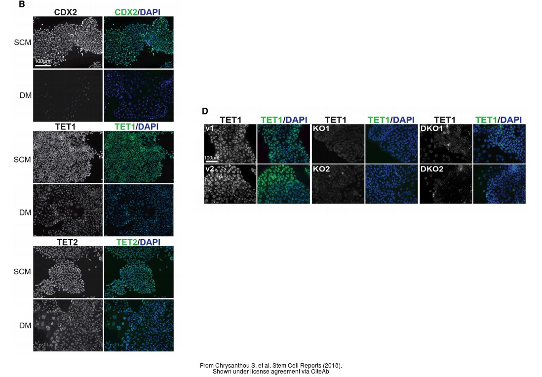 TET1抗体 [N1], N-term (GTX125888) | GeneTex中国官方网站