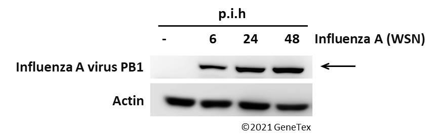 Influenza A virus PB1 protein抗体 (GTX125923) | GeneTex中文官方网站