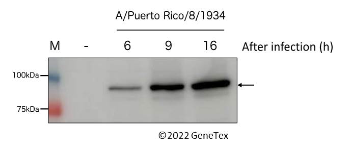 Influenza A virus PB1 protein抗体 (GTX125923) | GeneTex中文官方网站