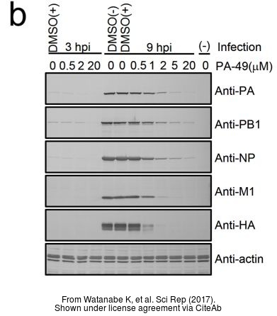 Influenza A virus M1 (matrix protein)抗体 (GTX125928) | GeneTex中国官方网站