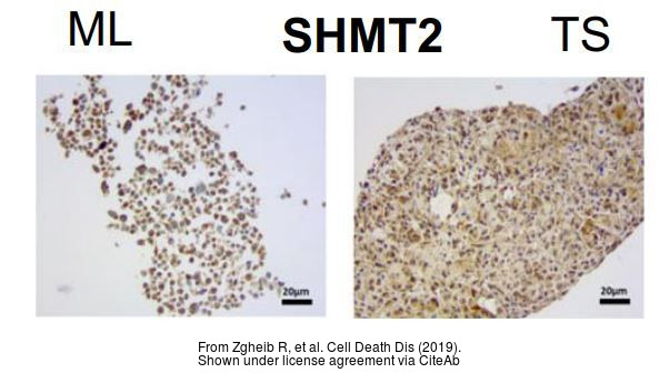 SHMT2抗体 (GTX125939) | GeneTex中国官方网站
