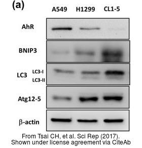 LC3B抗体 (GTX127375) | GeneTex中国官方网站