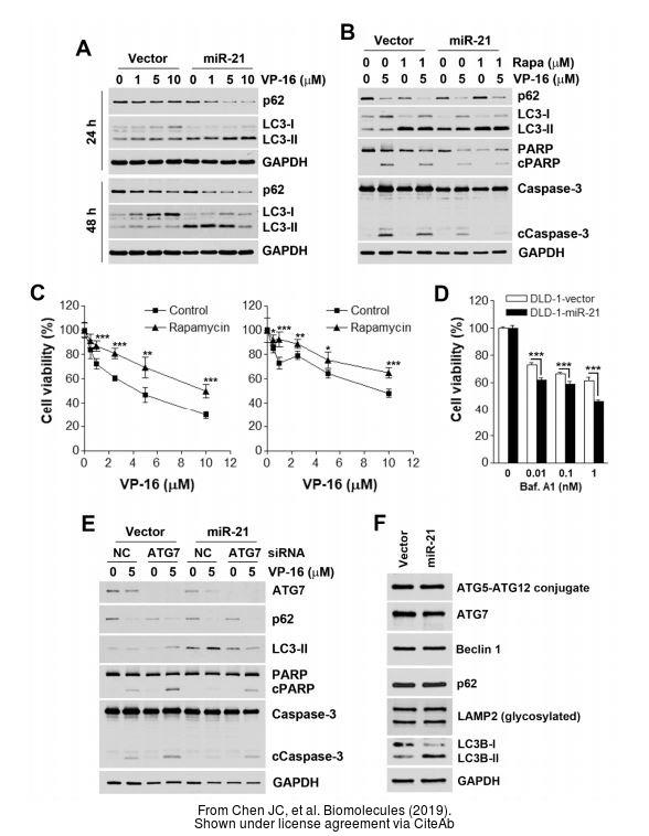LC3B抗体 (GTX127375) | GeneTex中国官方网站