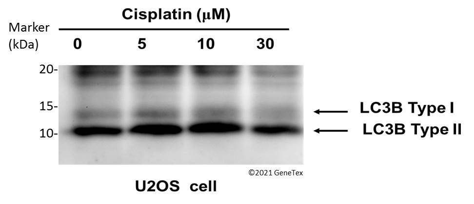LC3B抗体 (GTX127375) | GeneTex中文官方网站