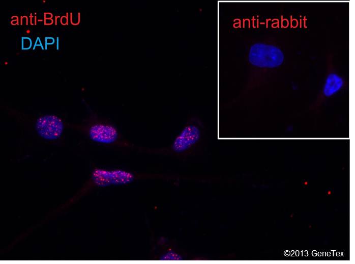 BrdU抗体 (GTX128091) | GeneTex中文官方网站