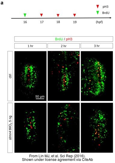 Histone H3S10ph (phospho Ser10)抗体 (GTX128116) | GeneTex中国官方网站