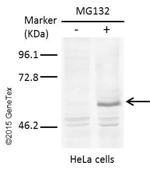SQSTM1 / P62 (phospho Ser403)抗体 (GTX128171) | GeneTex中文官方网站