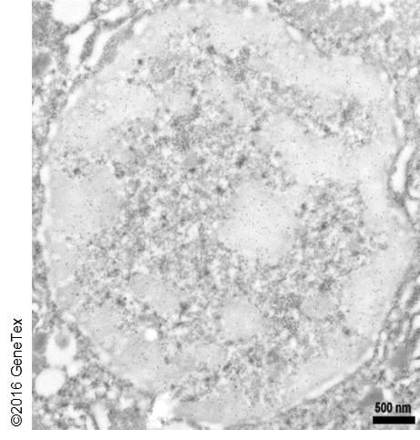5-Methylcytosine / 5-mC抗体 (GTX128455) | GeneTex中文官方网站