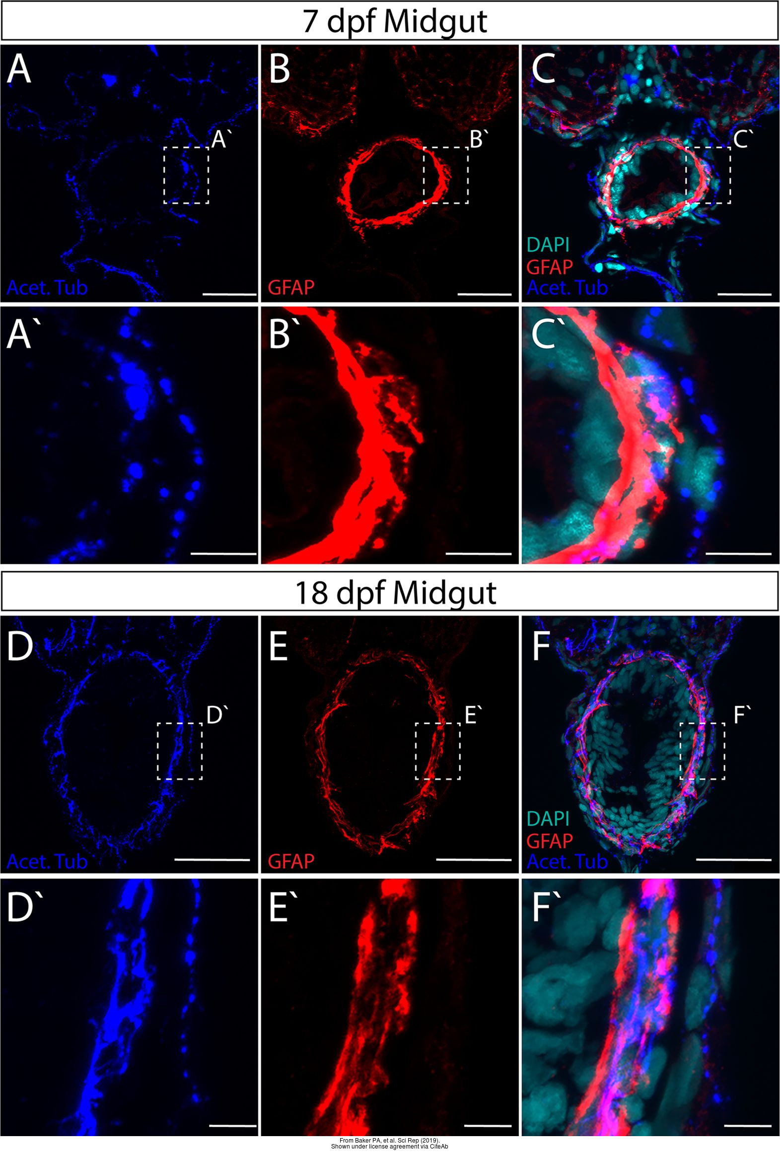 Gfap抗体 (GTX128741) | GeneTex中国官方网站