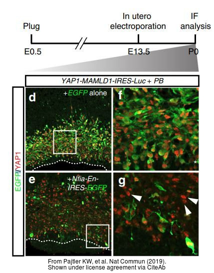 YAP1抗体 (GTX129151) | GeneTex中国官方网站