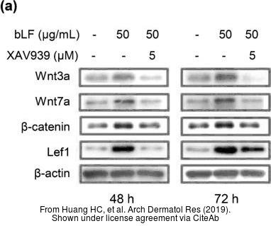 LEF1抗体 (GTX129186) | GeneTex中国官方网站