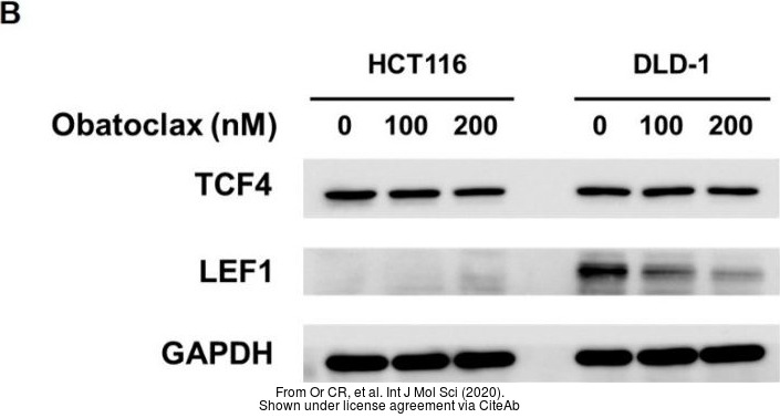 LEF1抗体 (GTX129186) | GeneTex中国官方网站