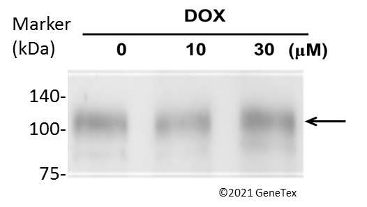PERK抗体 (GTX129275) | GeneTex中国官方网站