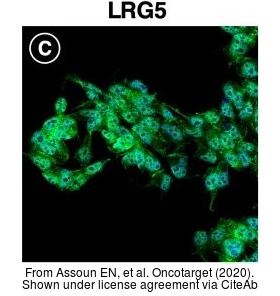LGR5抗体 (GTX129862) | GeneTex中国官方网站