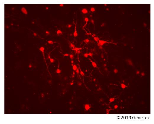 beta Tubulin 3/ Tuj1抗体 (GTX130245) | GeneTex中国官方网站