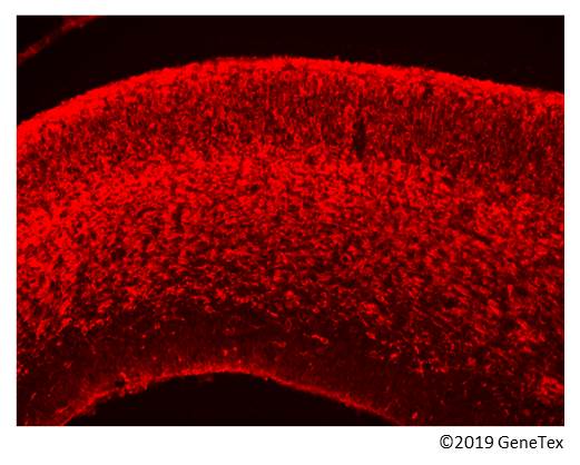 beta Tubulin 3/ Tuj1抗体 (GTX130245) | GeneTex中国官方网站