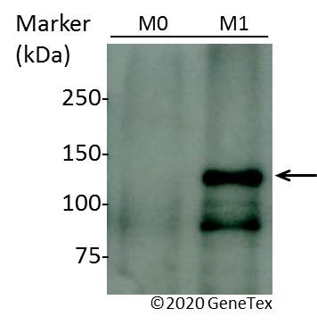 iNOS抗体 (GTX130246) | GeneTex中文官方网站