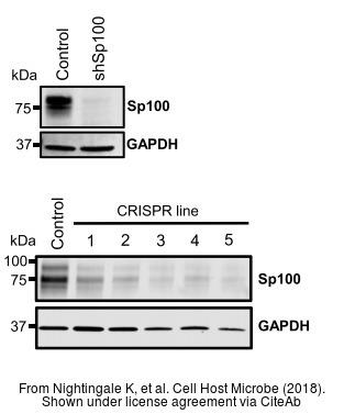 SP100抗体 (GTX131570) | GeneTex中国官方网站