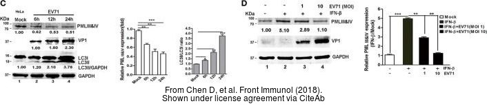 Enterovirus 71 VP1抗体 (GTX132338) | GeneTex中国官方网站
