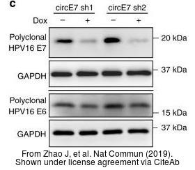 Human Papillomavirus type 16 E6抗体 (GTX132686) | GeneTex中国官方网站