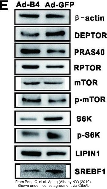 mTOR (phospho Ser2448)抗体 (GTX132803) | GeneTex中国官方网站