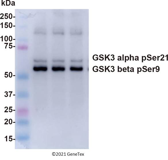 GSK3 alpha (phospho Ser21) + GSK3 beta (phospho Ser9)抗体 (GTX132997 ...