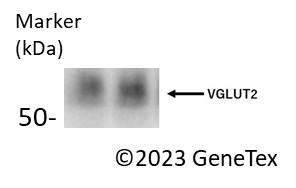 VGLUT2抗体 (GTX133142) | GeneTex中国官方网站