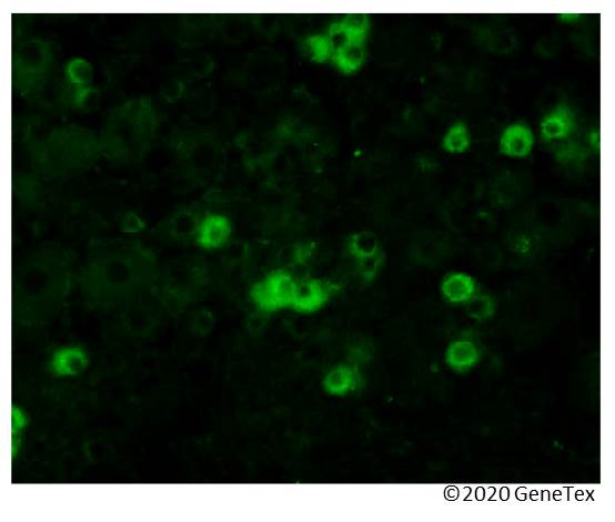 vGluT3抗体 (GTX133267) | GeneTex中国官方网站