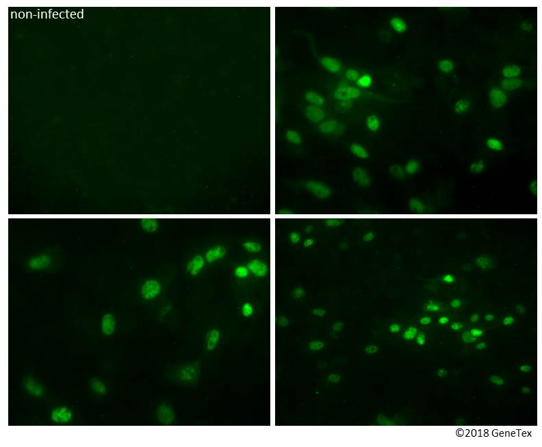 Porcine circovirus type 2 / PCV2 replicase抗体 (GTX133638) | GeneTex中国官方网站