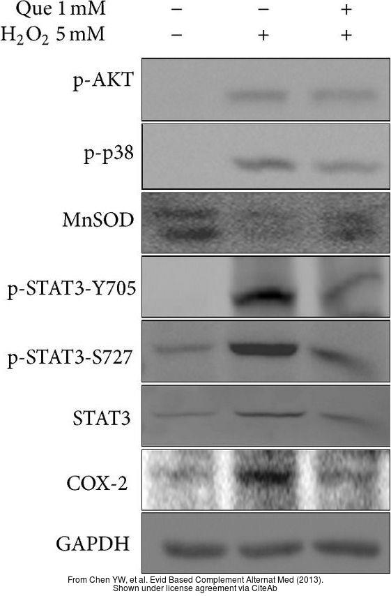 SOD2抗体 (GTX13533) | GeneTex中国官方网站