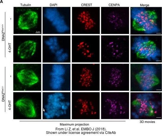 CENPA抗体 [3-19] (GTX13939) | GeneTex中国官方网站