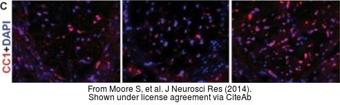 APC抗体 [CC-1] (GTX16794) | GeneTex中国官方网站