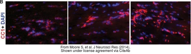 APC抗体 [CC-1] (GTX16794) | GeneTex中国官方网站