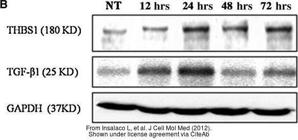 TGF beta抗体 [TB21] (GTX21279) | GeneTex中国官方网站